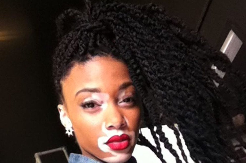 Winnie Harlow Reminds Us How Much She Loves Her Natural Hair - Essence