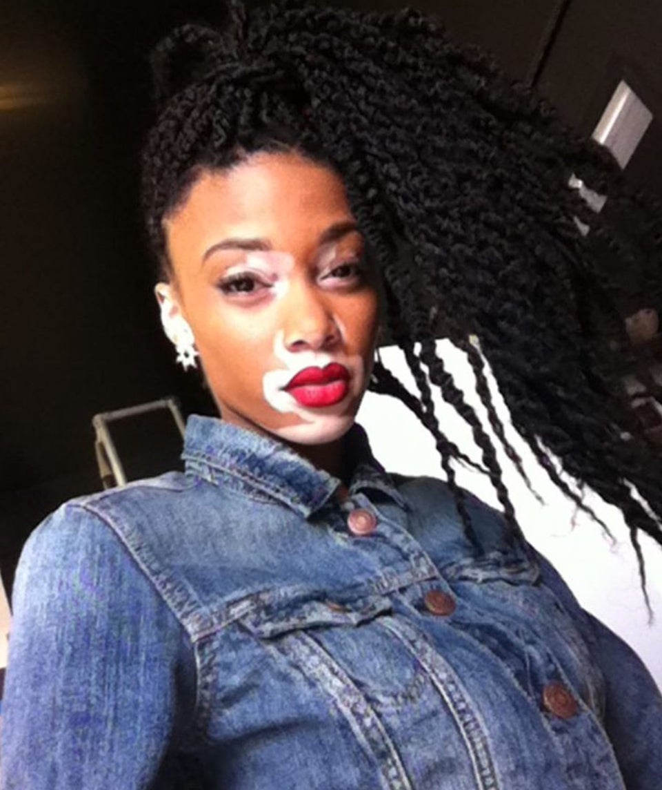 Winnie Harlow Reminds Us How Much She Loves Her Natural Hair - Essence