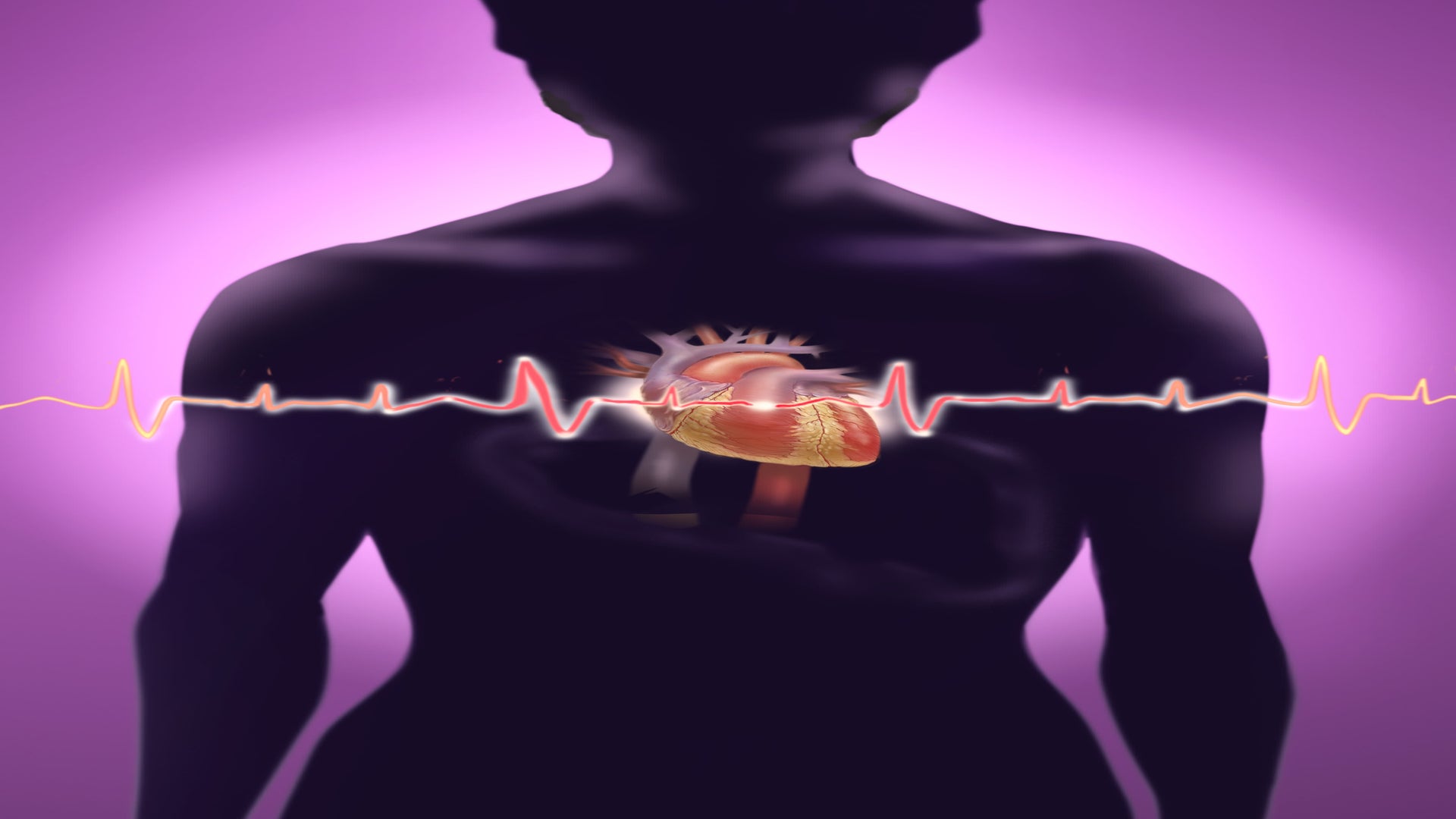 What It's Like to Have a Heart Attack in Your 20s or 30s - Essence