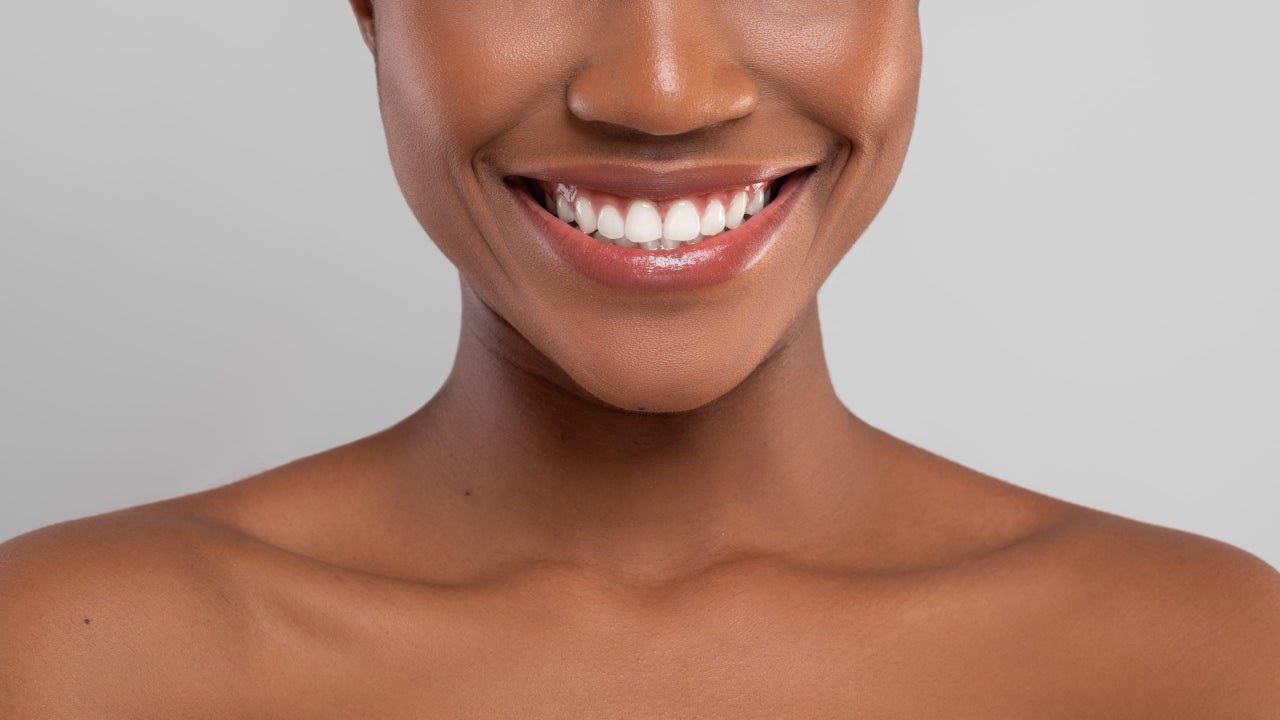 The Best Teeth Whitening Kits For A Brighter Smile | Essence