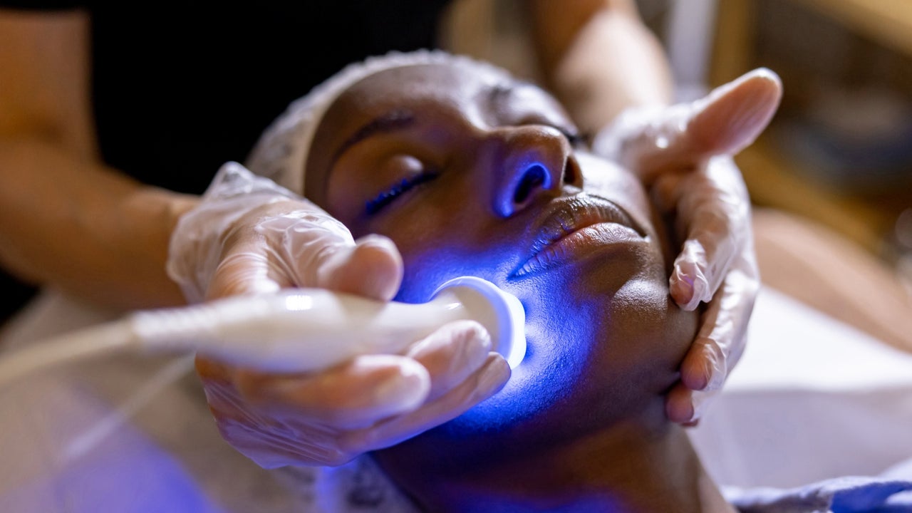 I Tried AviClear– The Original Laser For Long-Term Acne Treatment | Essence