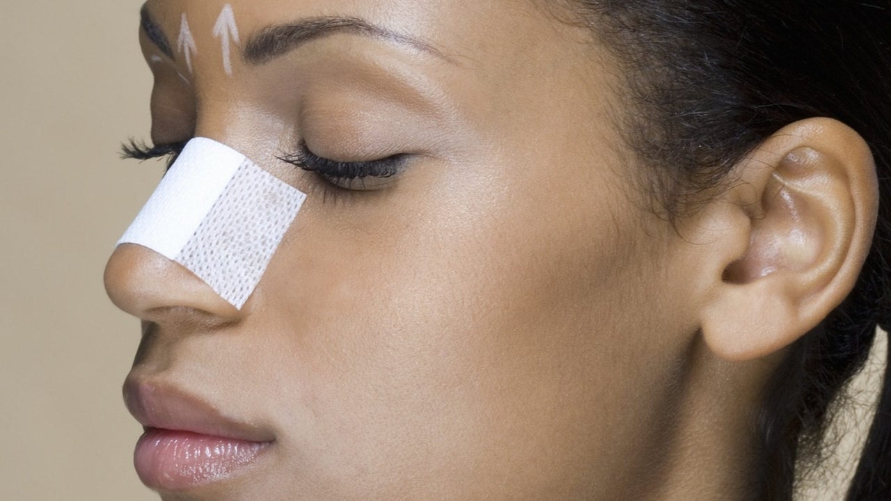 What Is The “Ethnic” Nose Job? - Essence | Essence