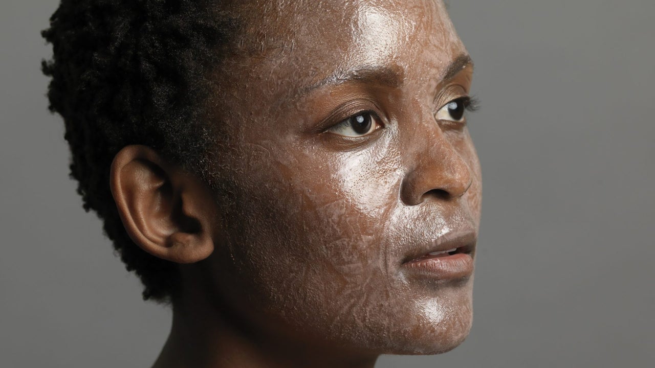 Everything Black Women Should Know About Chemical Peels - Essence | Essence